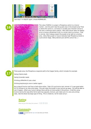 Diy diagnostic imaging! | PDF | Cancer | Diseases and Conditions