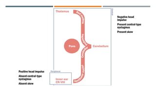 DIZZINESS & VERTIGO evaluation of dizzy patient | PPTX