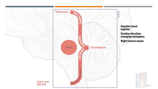 DIZZINESS & VERTIGO evaluation of dizzy patient | PPTX
