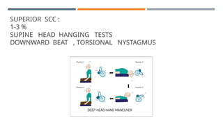 DIZZINESS & VERTIGO evaluation of dizzy patient | PPTX