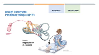 DIZZINESS & VERTIGO evaluation of dizzy patient | PPTX