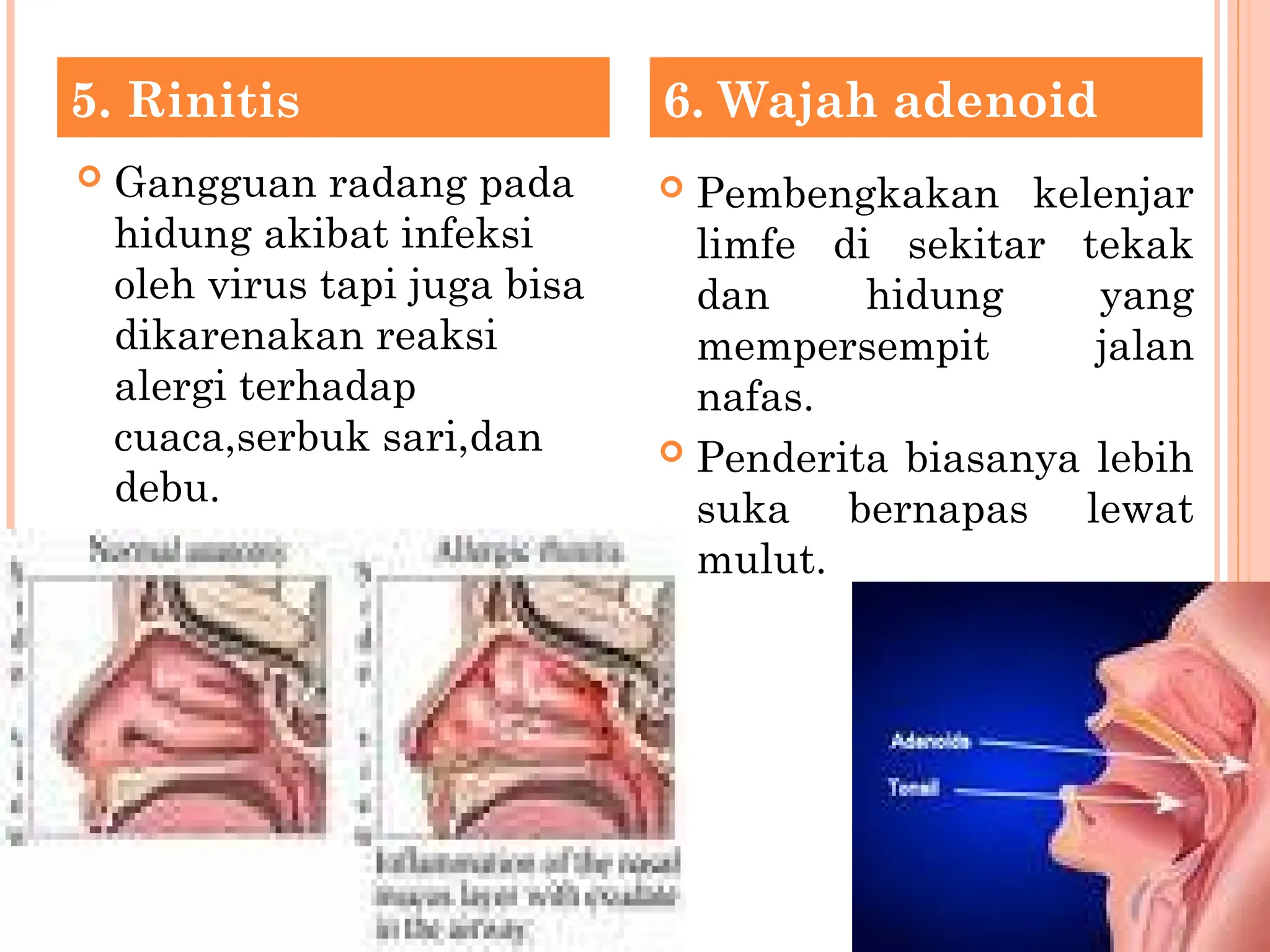 sistem pernapasan pada manusia kelas 8 Kurikulum Merdeka.ppt