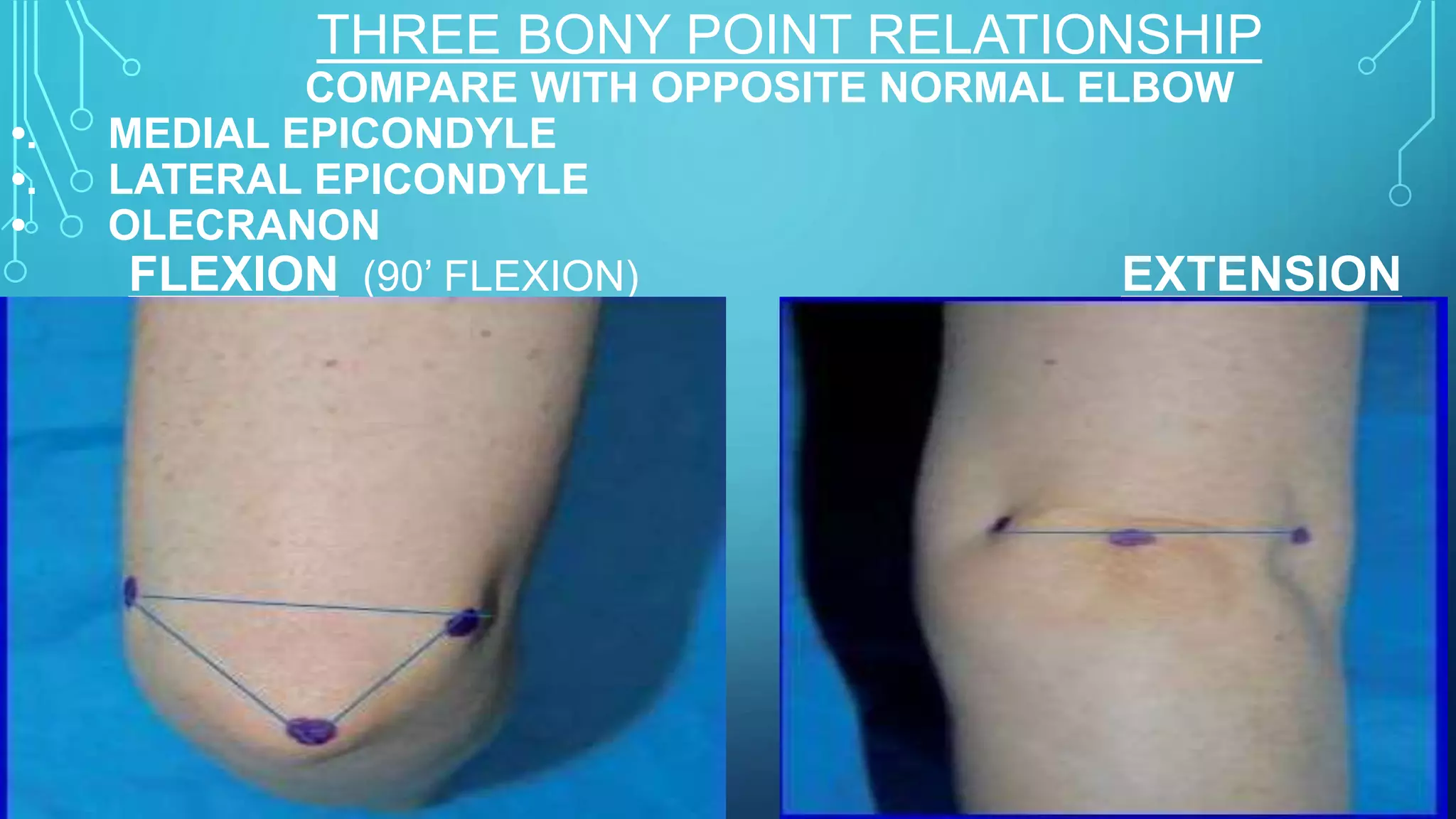 Elbow examination and its clinical applied | PPT