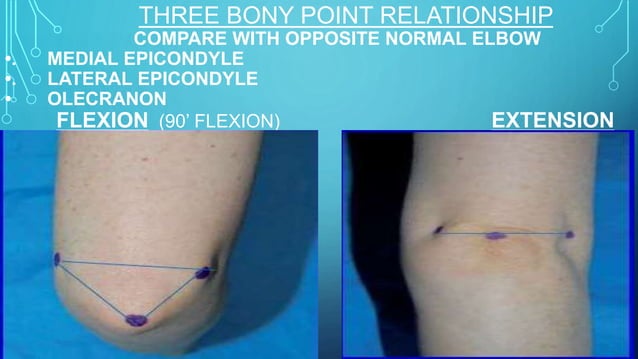 Elbow examination and its clinical applied | PPT