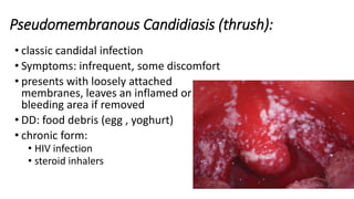 3rd lecture fungal infection | PPTX