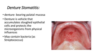 3rd lecture fungal infection | PPTX
