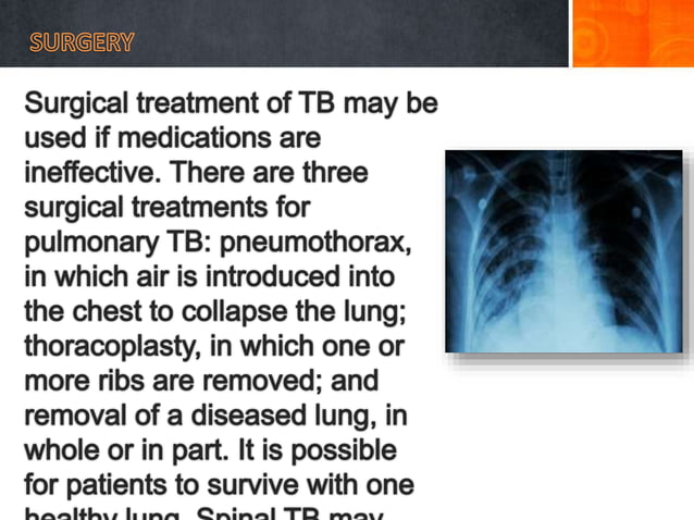 TB PRESENTATION | PPTX | Lung and Respiratory Health | Diseases and ...