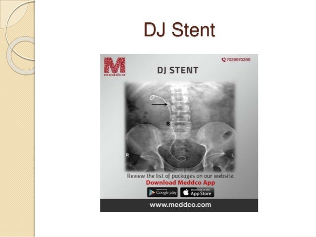 Dj stent meddco | PPTX