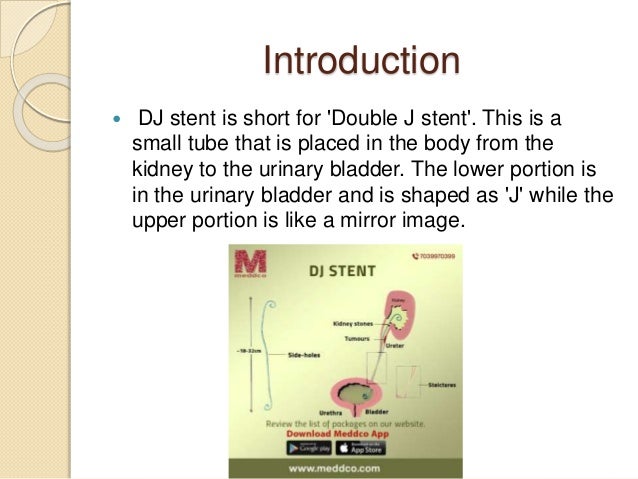 Dj stent meddco | PPTX