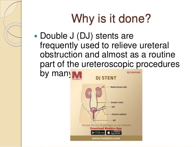 Dj stent meddco | PPTX