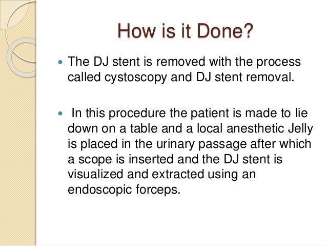 Dj stent meddco | PPTX