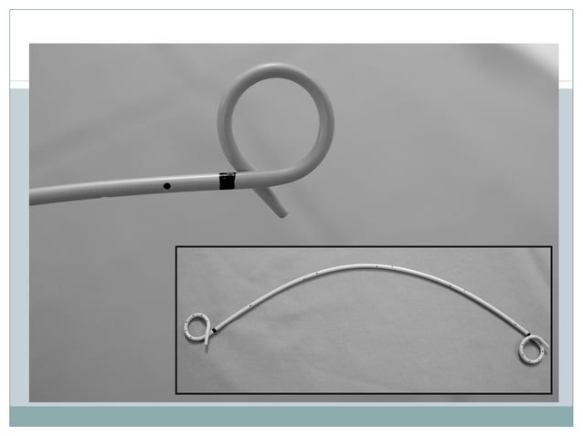 DJ Stenting or Percutaneous nephrostomy(PCN) in acute pyelonephritis | PPT