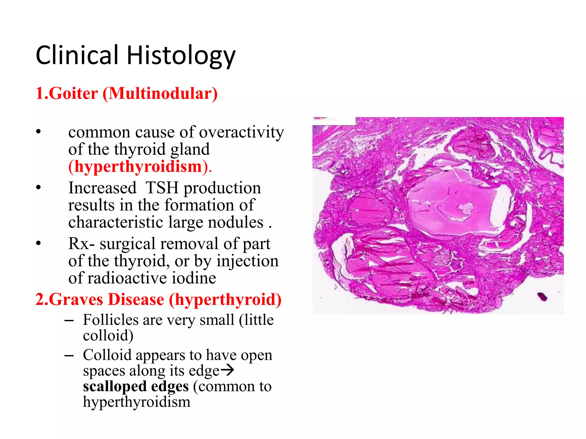 Histology of Endocrine system. | PPTX