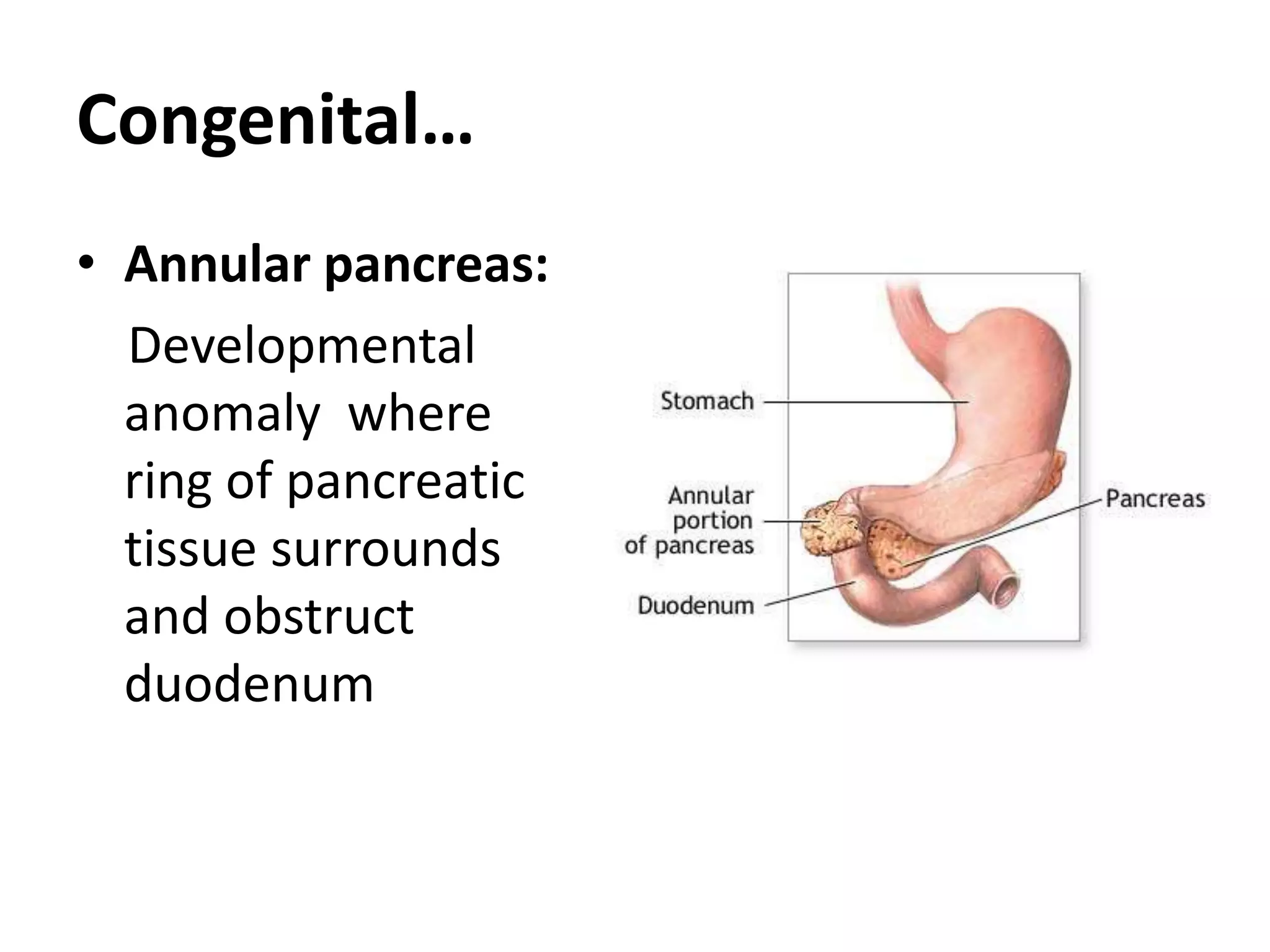 ANATOMY OF PANCREAS | PPTX