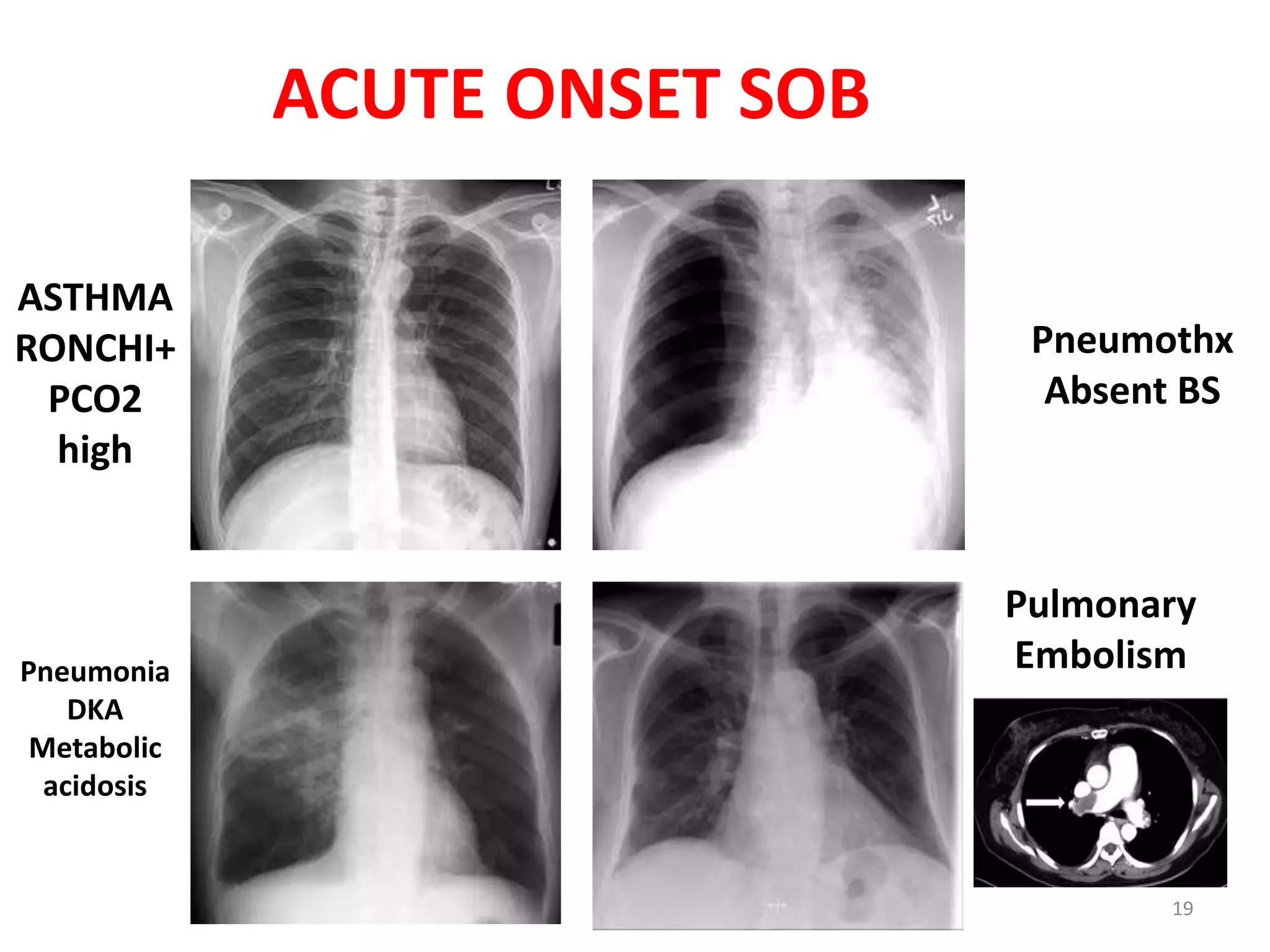 HEART FAILURE MANAGEMENT | PPTX