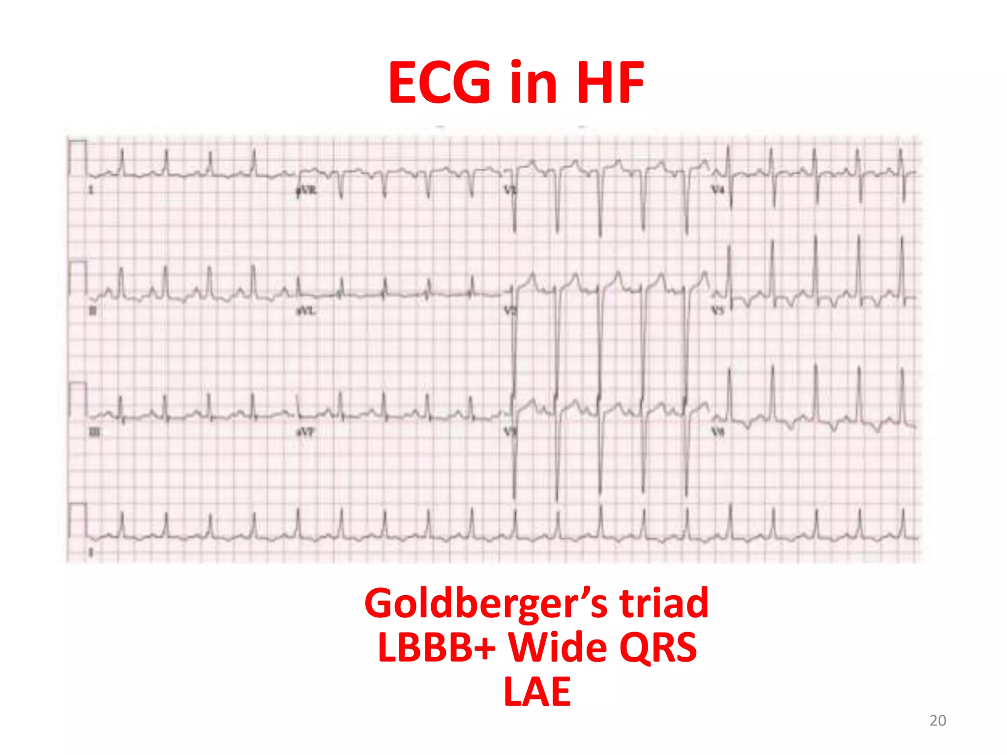 HEART FAILURE MANAGEMENT | PPTX