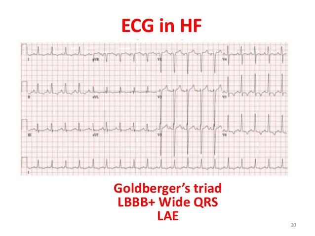 HEART FAILURE MANAGEMENT