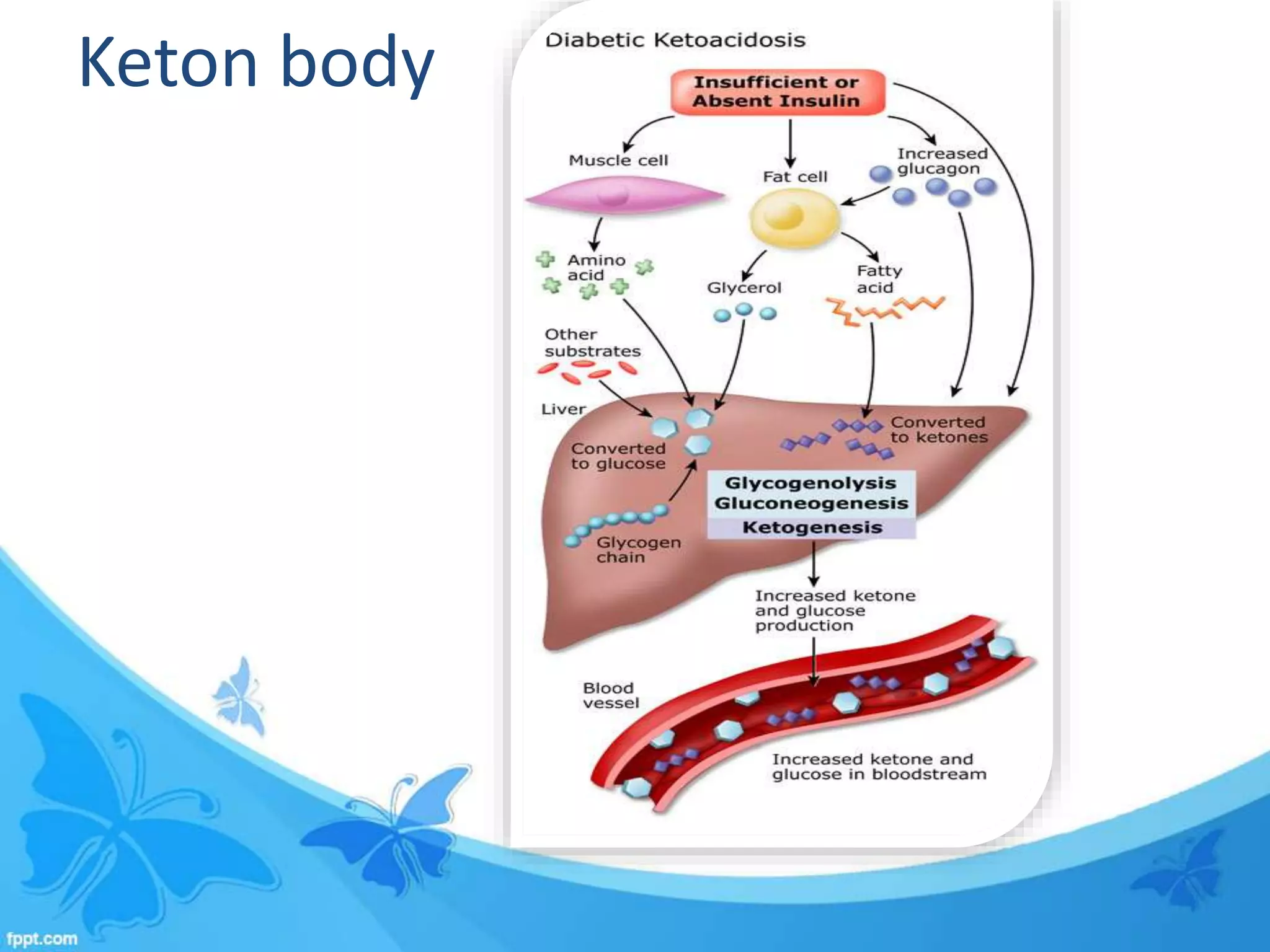 diabetic ketoacidosis DKA | PPT