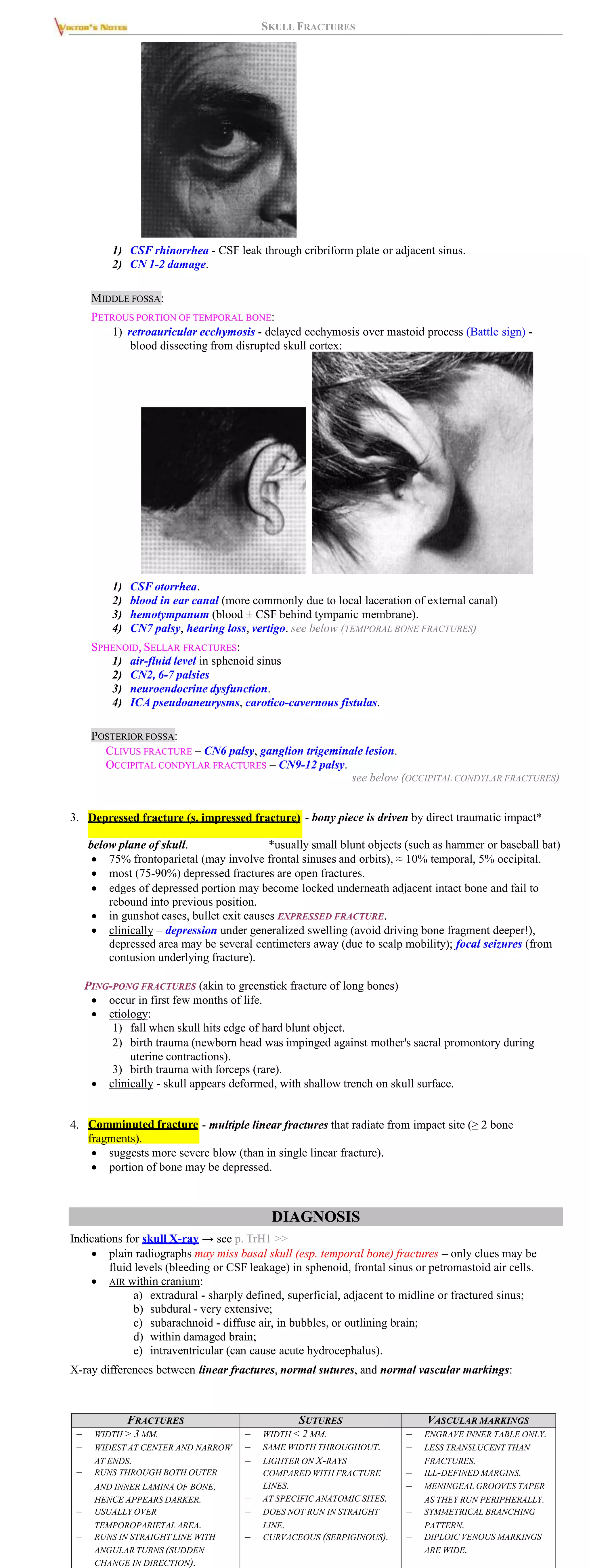 SKULL FRACTURES | PPTX