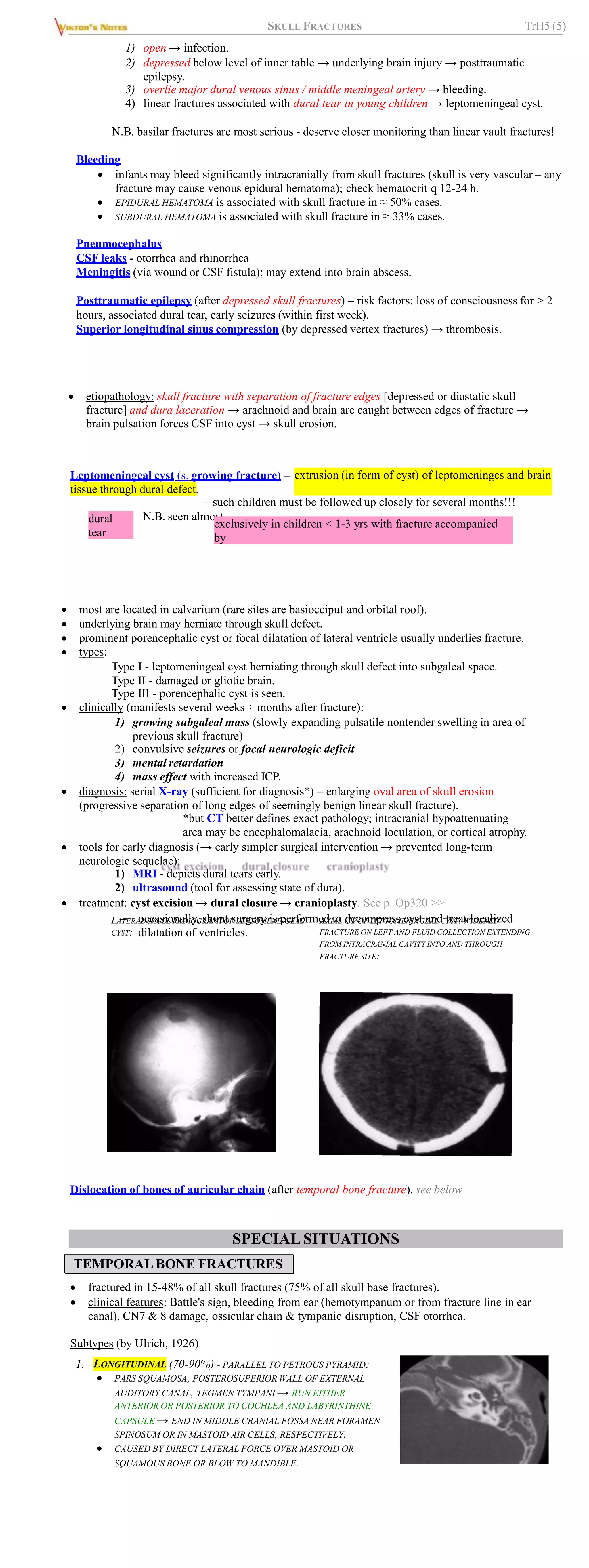 SKULL FRACTURES | PPTX