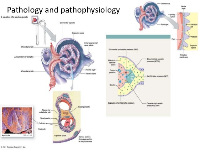 pathophysiology and therapy of diabetic nephropathy