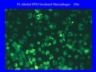 Spio mri studies by dr naghavi | PPT