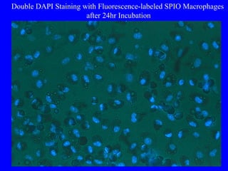 Spio mri studies by dr naghavi | PPT