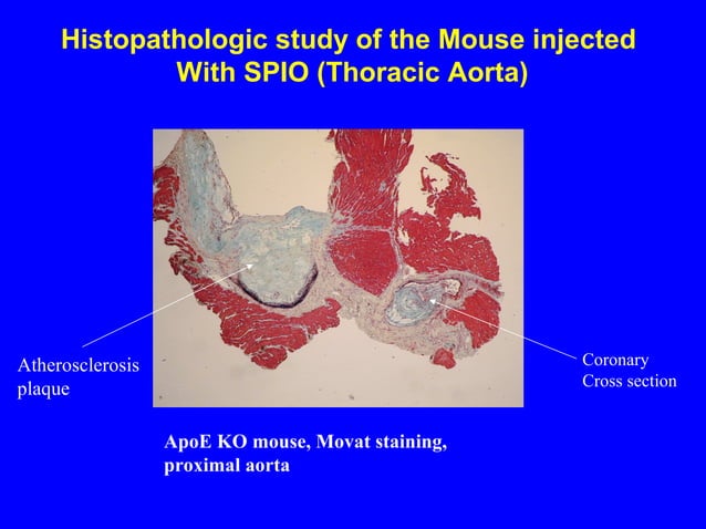 Spio mri studies by dr naghavi | PPT