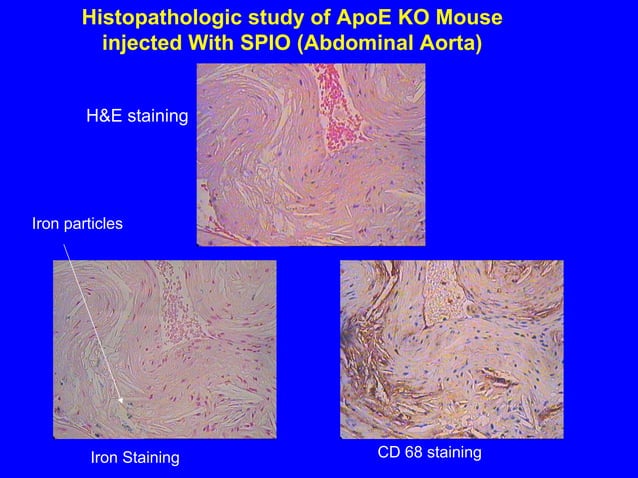 Spio mri studies by dr naghavi | PPT