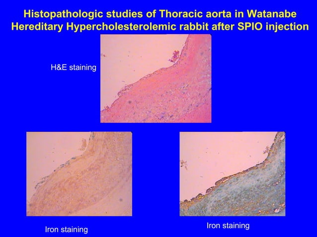 Spio mri studies by dr naghavi | PPT