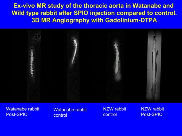 Spio mri studies by dr naghavi | PPT