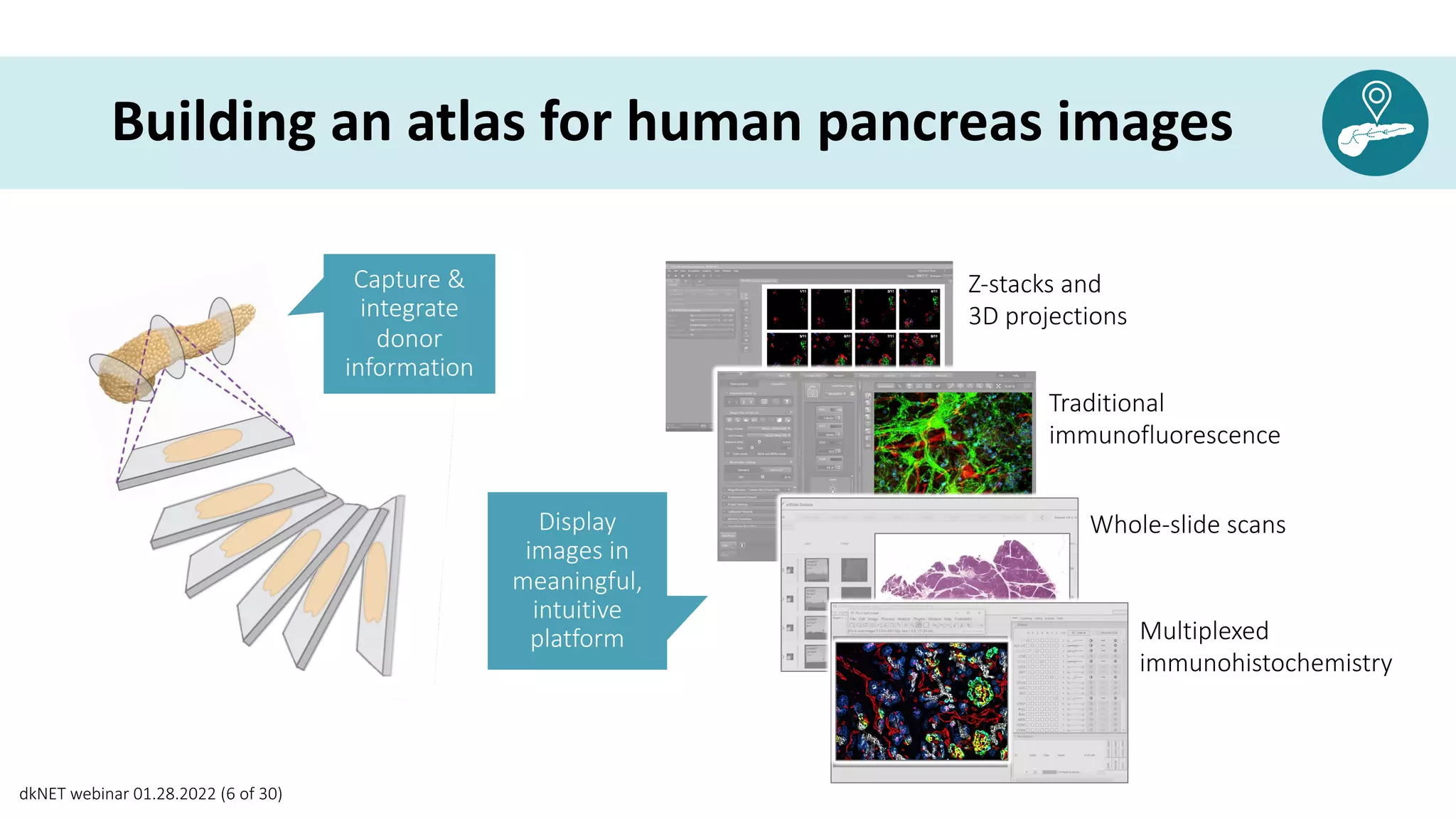 dkNET Webinar "Pancreatlas™: Mapping the Human Pancreas in Health and Disease" 01/28/2022 | PDF