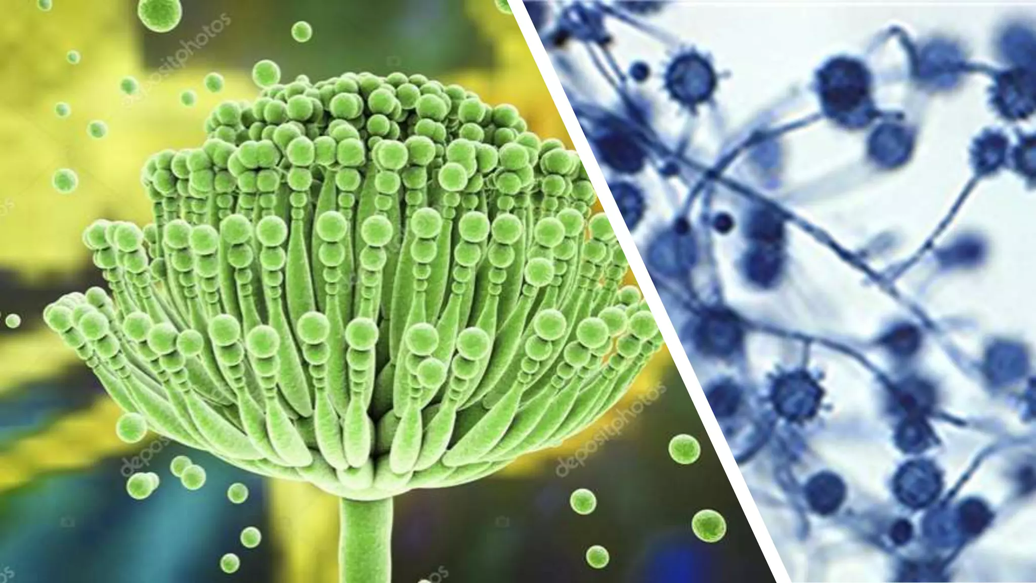 Fungal pneumonia 11 | PPTX
