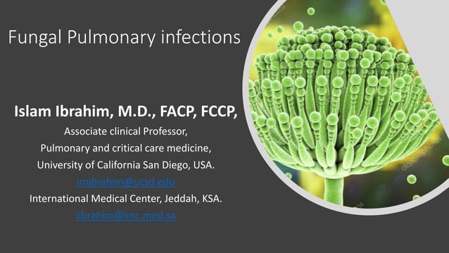 Fungal pneumonia 11 | PPTX