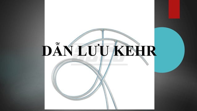 Dẫn lưu kehr | PPT