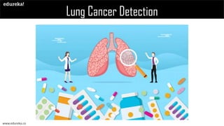 Deep Learning Projects | Edureka | PDF