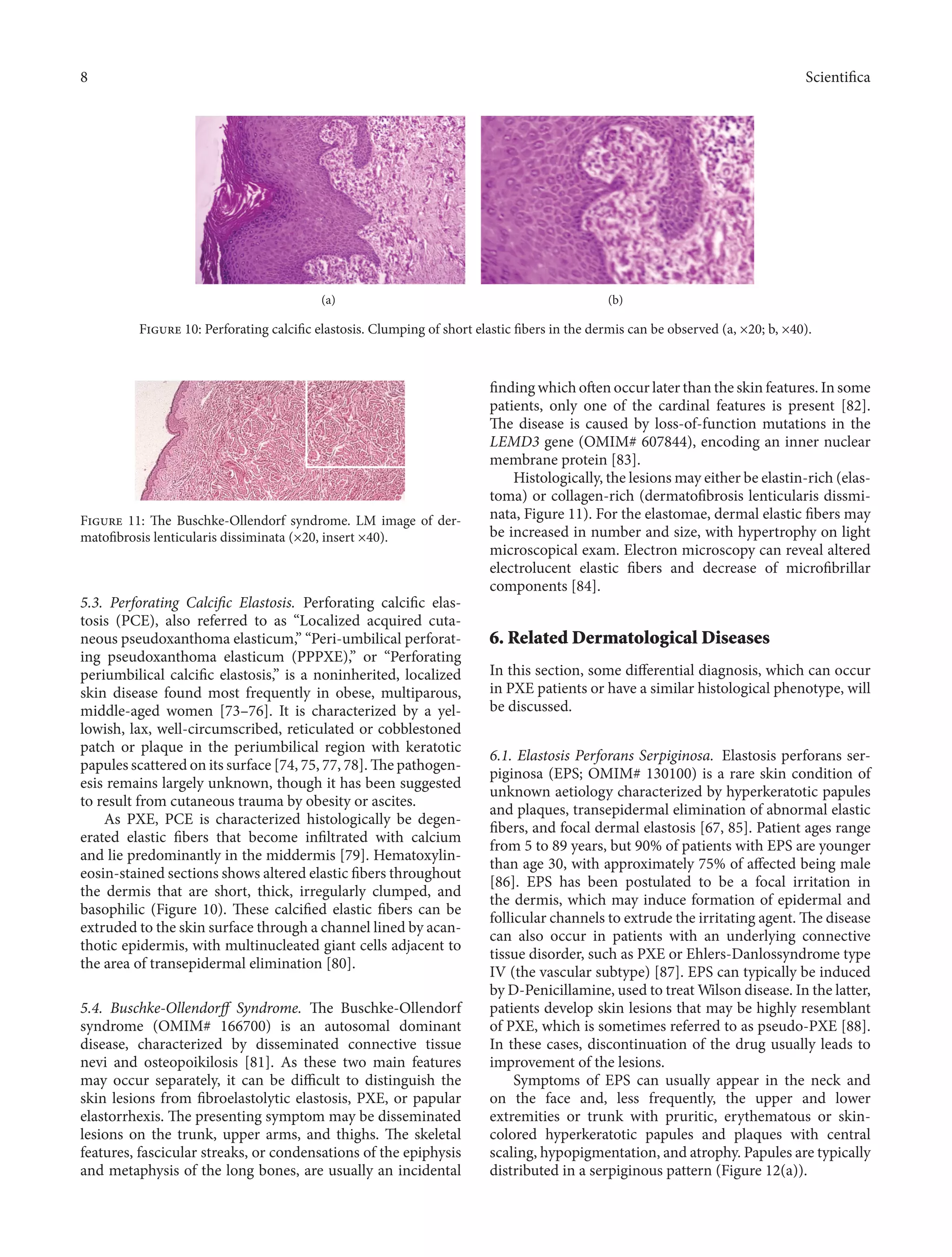 Histopathology_of_Pseudoxanthoma_Elasticum_and_Related.pdf