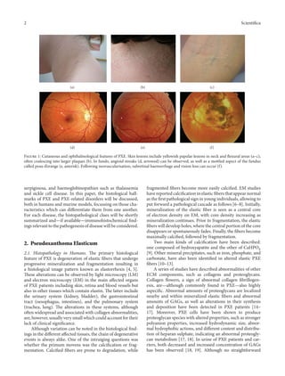 Histopathology_of_Pseudoxanthoma_Elasticum_and_Related.pdf