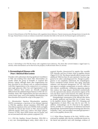 Histopathology_of_Pseudoxanthoma_Elasticum_and_Related.pdf
