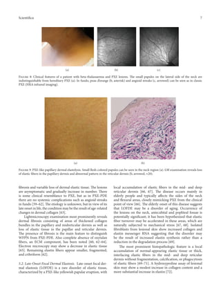 Histopathology_of_Pseudoxanthoma_Elasticum_and_Related.pdf