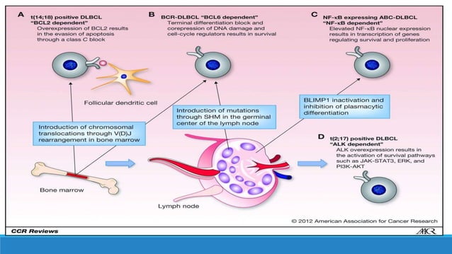 DLBCL | PPT