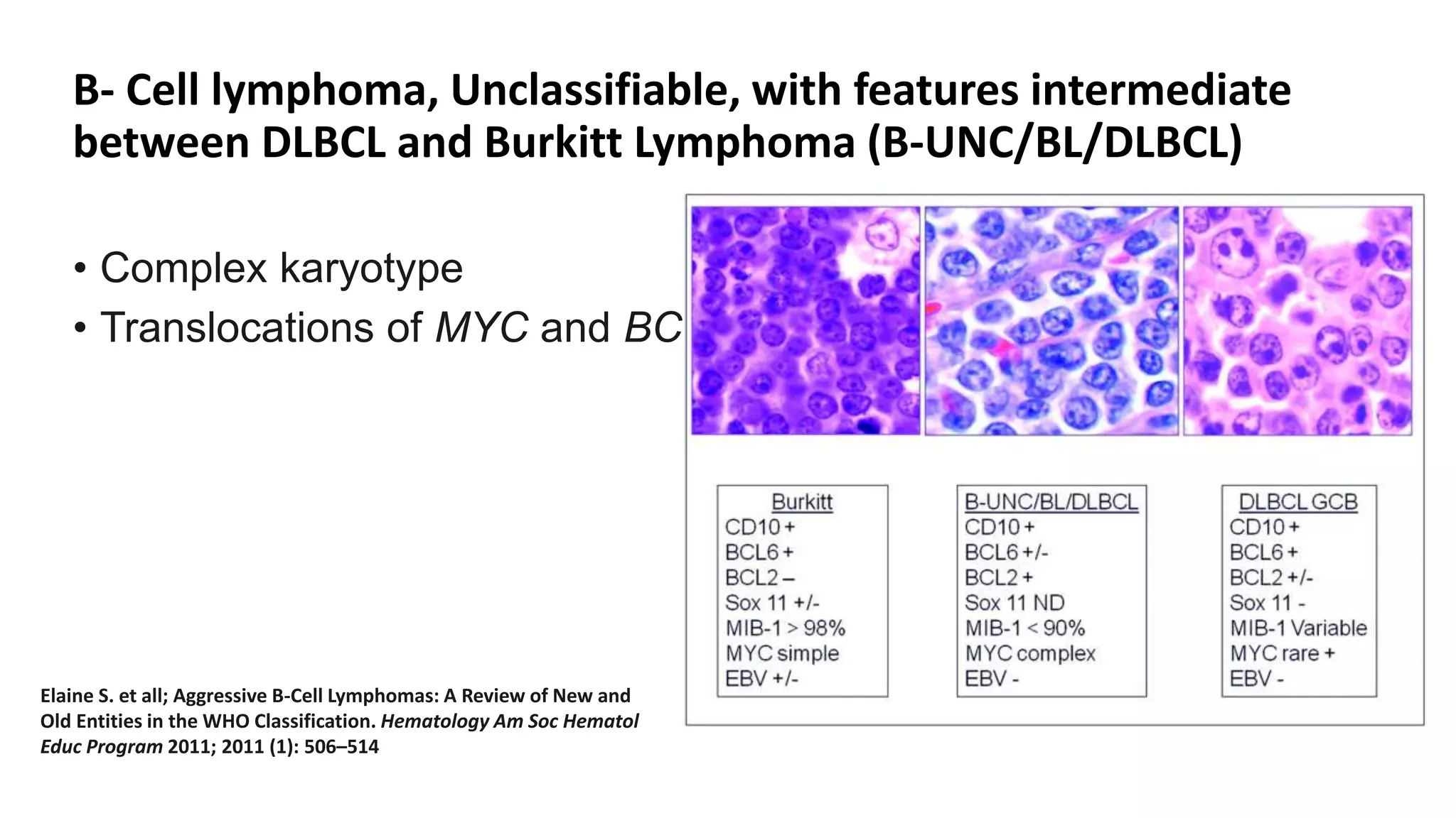 DLBCL- Recent Molecular Classification.pptx