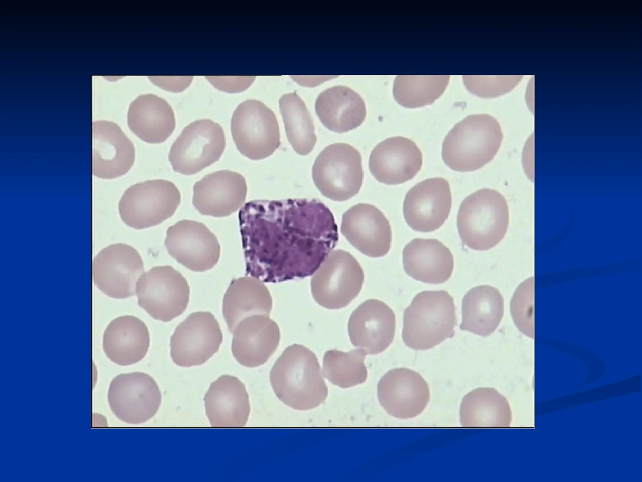 Differential leucocyte count white blood cell | PPT
