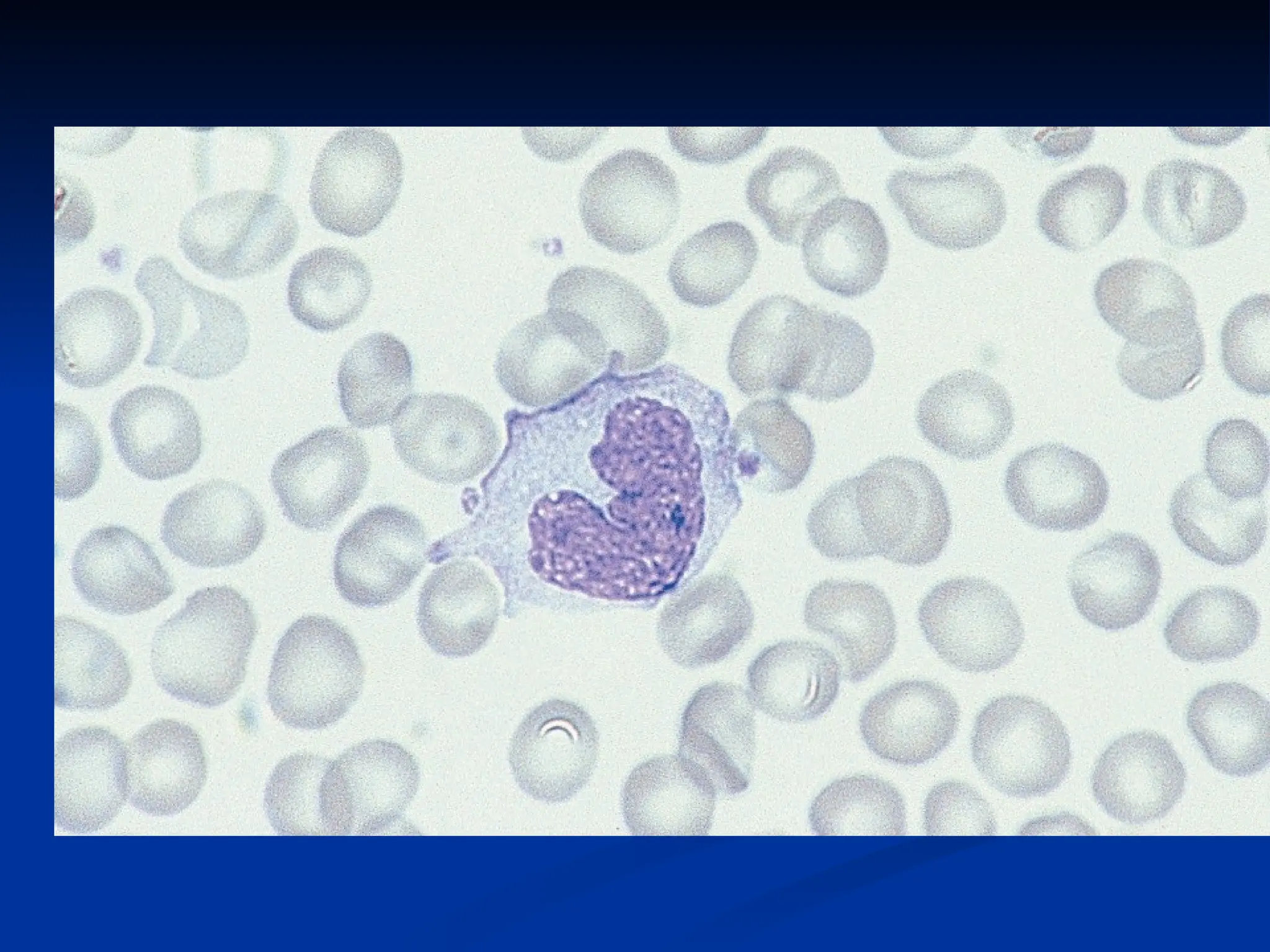 Differential leucocyte count white blood cell | PPT