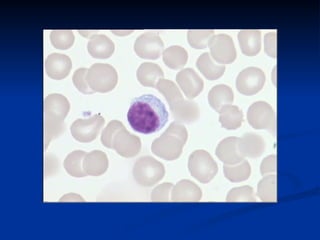 Differential leucocyte count white blood cell | PPT