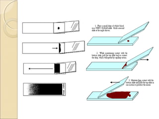 Dlc by peripheral smear comparison with automated differential | PPT