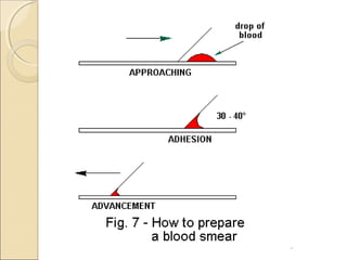 Dlc by peripheral smear comparison with automated differential | PPT