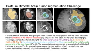 Deep Learning for Computer Vision: Medical Imaging (UPC 2016) | PDF
