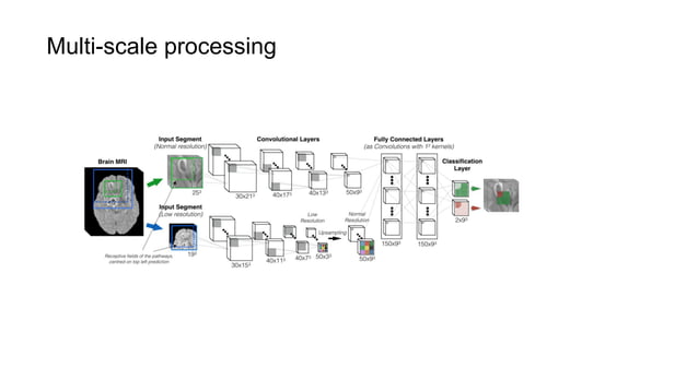 Deep Learning for Computer Vision: Medical Imaging (UPC 2016) | PDF