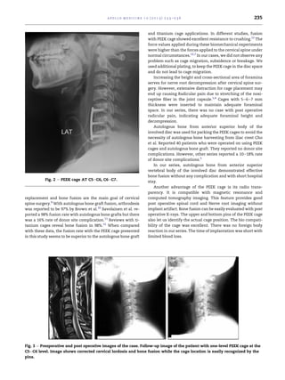 Polyetheretherketone (PEEK) cages for cervical interbody replacement ...